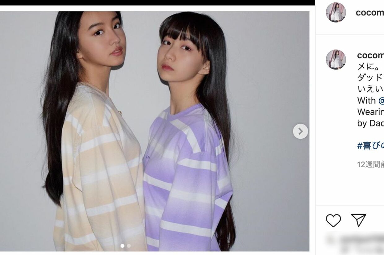 【画像・写真】CocomiとKoki,の顔面、どちらが美しい？ 美容整形外科医がジャッジ「決め手は横顔」 | 週刊女性PRIME